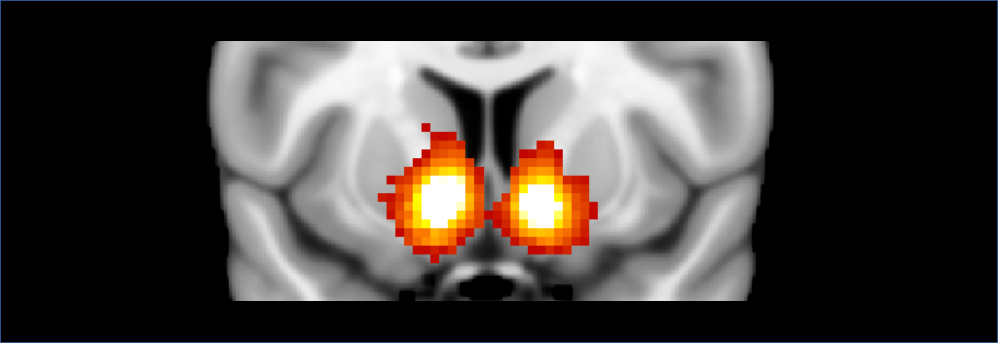 Nils Kroemer (@nbkroemer@mastodon.world) - Mastodon